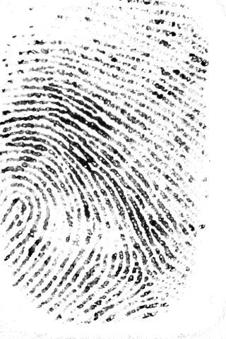OPD Consent